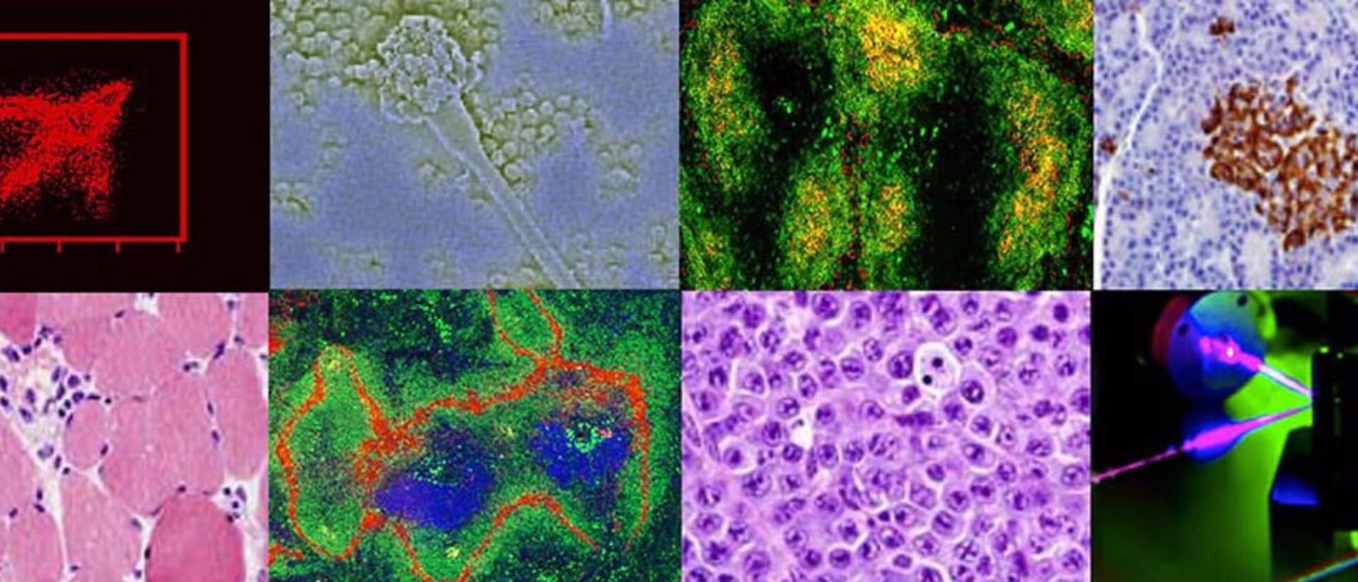 Master of Science in Pathology | Department of Pathology - Carver ...